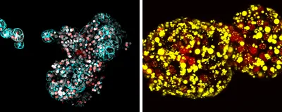 Working Together to Battle Fatty Liver Disorders | The Scientist