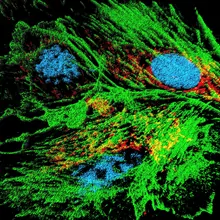 Spatial Biology | The Scientist