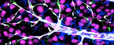 Rare Autism-Linked Mutation Starves Growing Neurons of Essential ...