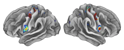 New Brain Network Connecting Mind and Body Discovered | The Scientist