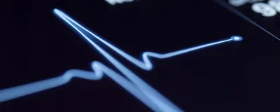 The Circadian Rhythm of the Heart Rate | The Scientist