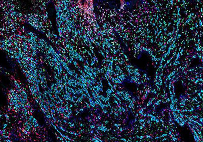 The Cellular Intricacies of the Human Placenta | The Scientist