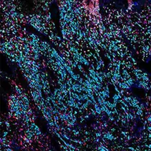 Placenta | The Scientist