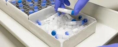 Discover the Freshness of Frozen PBMCs | The Scientist