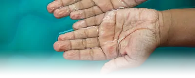 The Science Behind Pruney Fingers | The Scientist