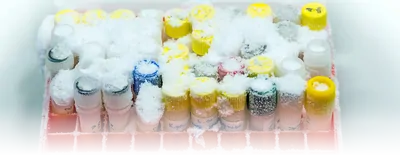 Save the Sample | The Scientist