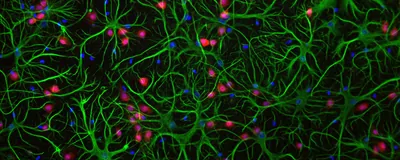 Troubleshooting Fluorescence Microscopy Experiments | The Scientist