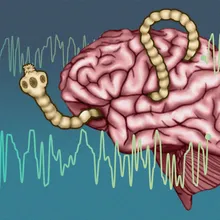 Electrophysiology | The Scientist