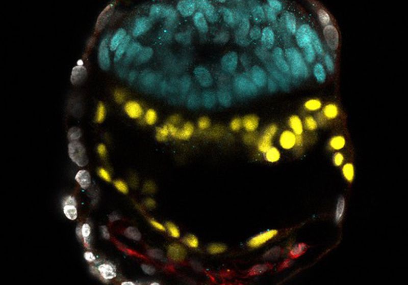 The First Human Embryo Model From Embryonic Stem Cells | The Scientist