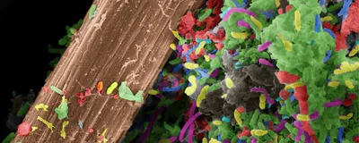 Electric Bacteria: Out of the Darkness and into the Light | The Scientist