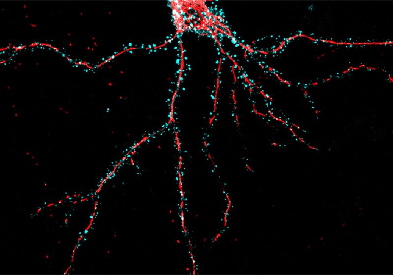 How Mitochondria Stay Still in Neurons | The Scientist