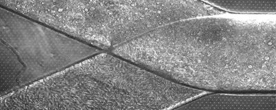 A Beating Heart on a Chip | The Scientist