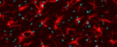 Friends and Foes: Astrocytes as Disease Targets | The Scientist