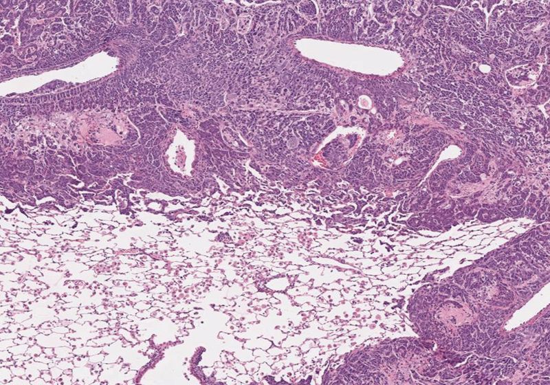 Lung Cancer Cells Switch Oncogenic Drivers | The Scientist