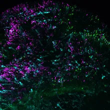 Retinal Organoids | The Scientist
