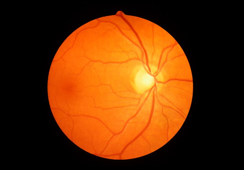 Gut Bacteria Slip into the Eye | The Scientist