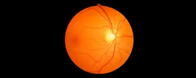 Gut Bacteria Slip into the Eye | The Scientist