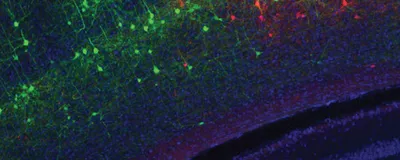 Engineered Rabies Virus Illuminates Neural Circuitry | The Scientist