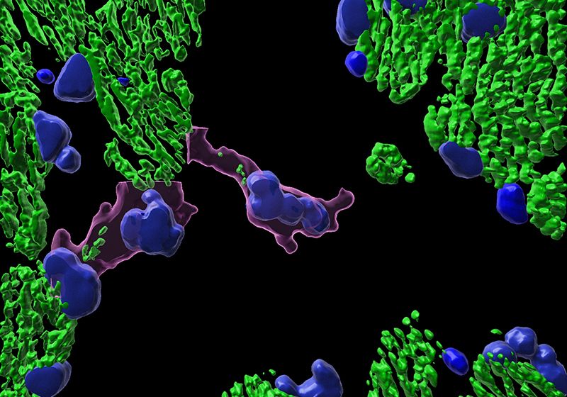 Taking Out the Trash: An Alternative Cellular Disposal Pathway | The ...