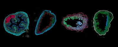 A Cellular Atlas of Gut Inflammation | The Scientist
