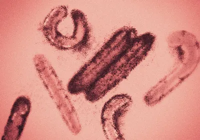 Preparing for Disease X in a Changing World | The Scientist