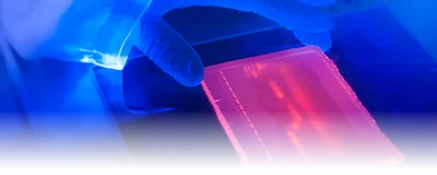 Automate and Illuminate Bioimaging Assays | The Scientist