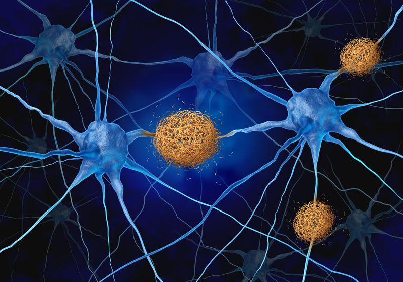 Neurodegenerative Disease Markers and Detection Methods | The Scientist