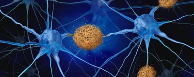 Neurodegenerative Disease Markers and Detection Methods | The Scientist