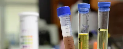 Achieving Better Test Sensitivity for Cancer Liquid Biopsies | The ...