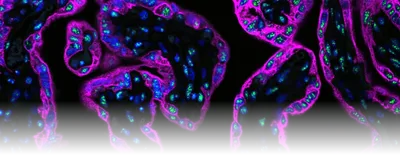 A Tissue-Sized Cell with Billions of Nuclei | The Scientist