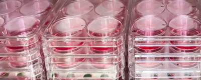 Optimizing Stem Cell Media for Cultivated Meat Production | The Scientist