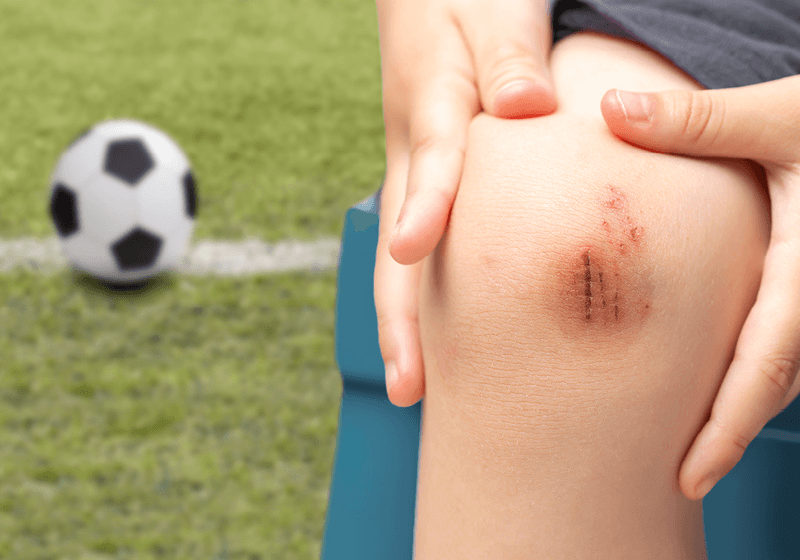 Time Heals All Wounds: Probing Skin Injuries with Spatial Biology | The ...