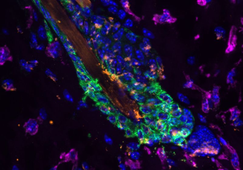 Stem Cells Dine on Dying Neighbors to Keep Tissues Fit | The Scientist