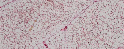 A Protein That Converts Fat-Storing Cells into Calorie-Burning Cells ...