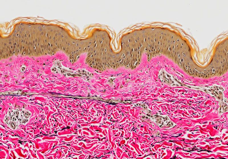 Sole Fibroblasts Injected into Thighs Help Develop a Thicker Skin | The ...