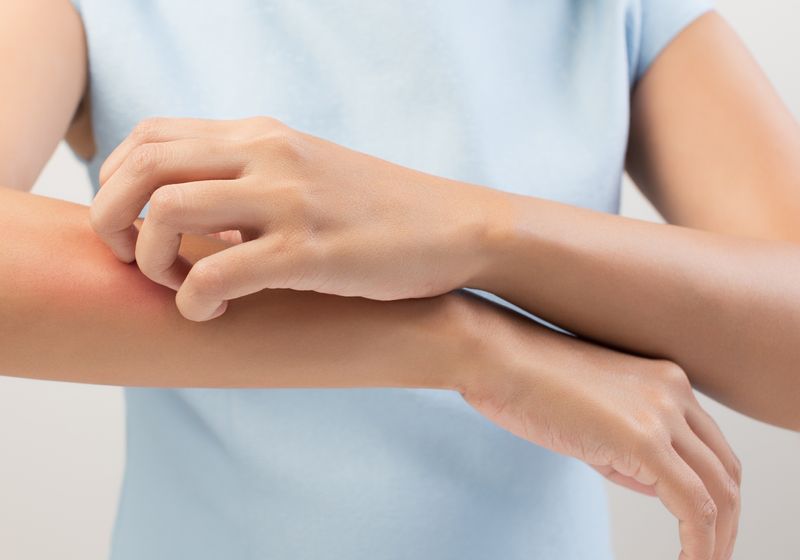 Why Do We Scratch an Itch? | The Scientist