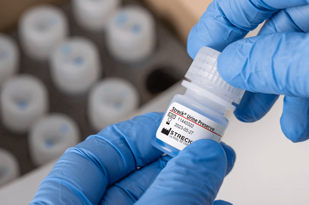 Improving Urine Nucleic Acid Target Stability | The Scientist