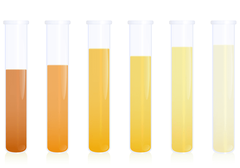 Improving Urine Nucleic Acid Target Stability | The Scientist