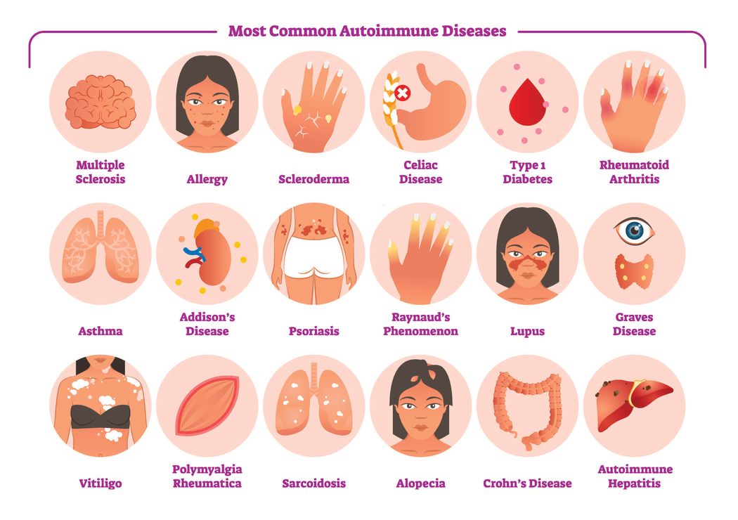 Autoimmune Disease Research Solutions | The Scientist