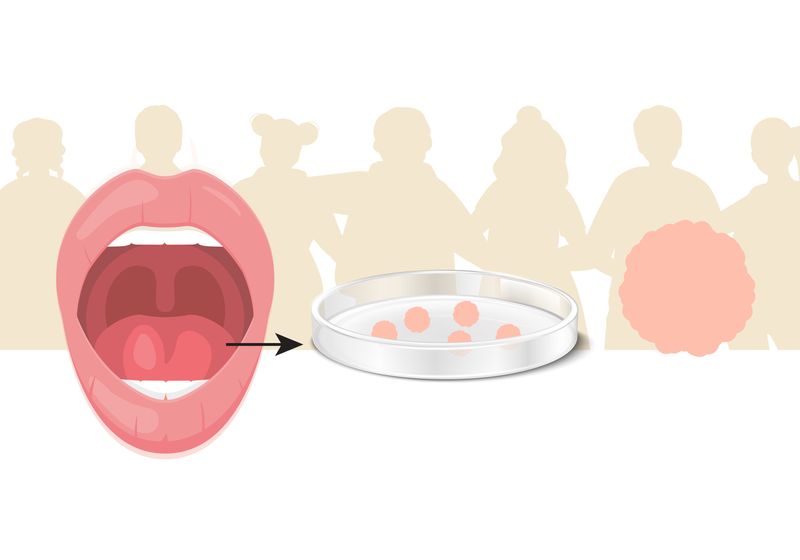 Building a Tongue Cancer Organoid Library | The Scientist