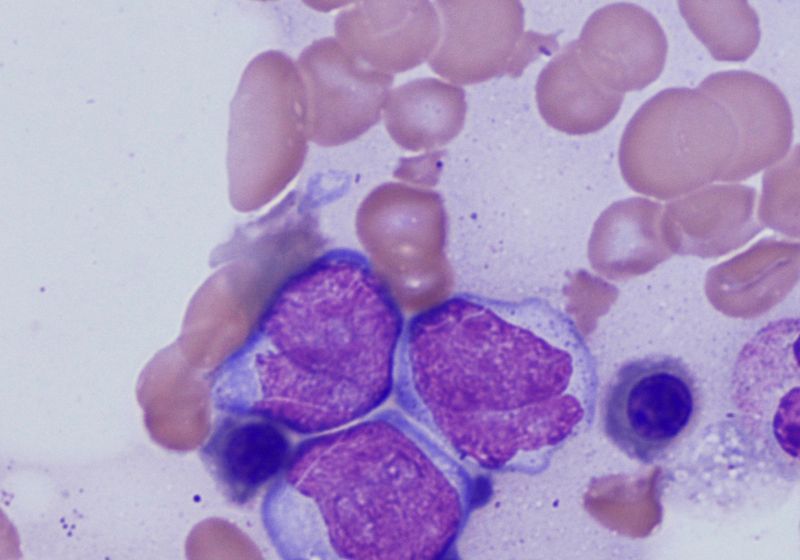 Final Destination: Distinct Cell Differentiation Patterns in Acute ...