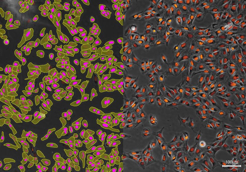 Leveraging AI for Analyzing Cell Transfection Efficiency | The Scientist