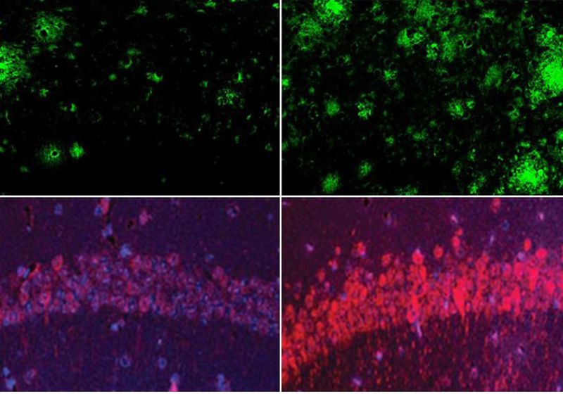 Low Brain Lithium Leads to Alzheimer’s Disease Pathology | The Scientist