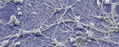 Light-Stimulated Graphene Activates and Matures Neurons | The Scientist