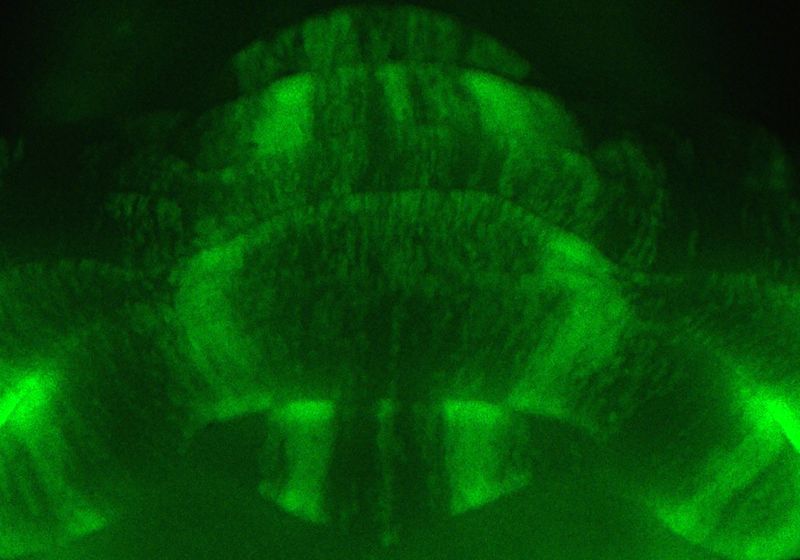 Aging Brains Show Stripes of Cell Death | The Scientist