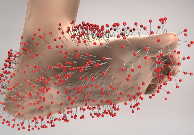What Causes the Pins and Needles Sensation? | The Scientist