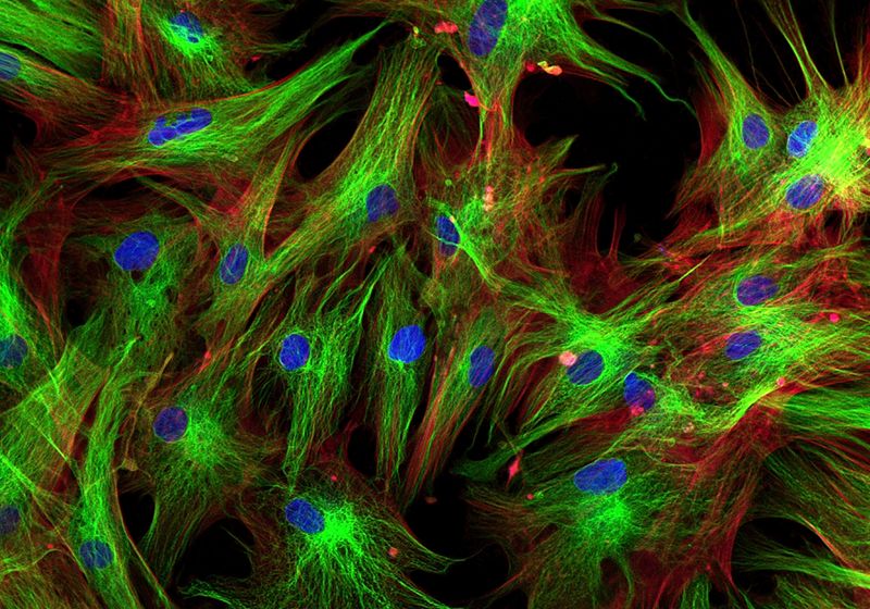 What’s the Best Cell? Scientists Choose Their Favorites | The Scientist