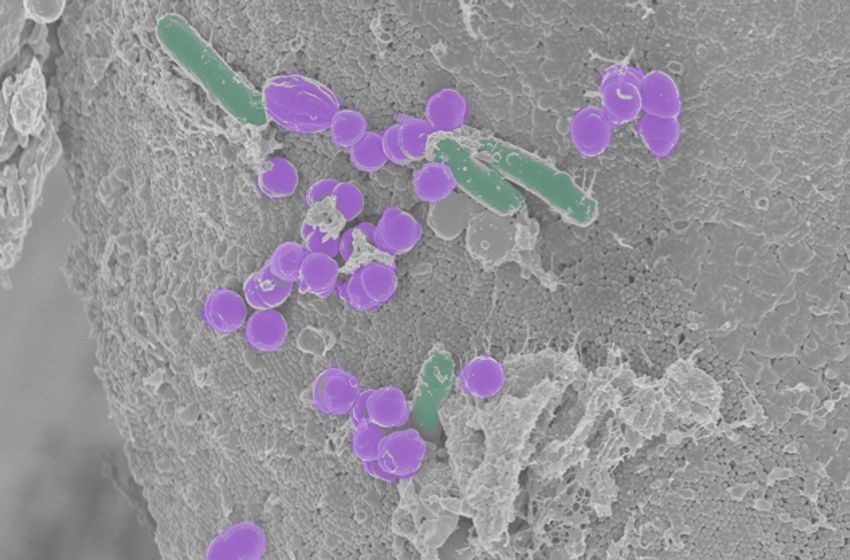 Microbial Interactions Act as a Noninvasive Biomarker for Gut Health ...