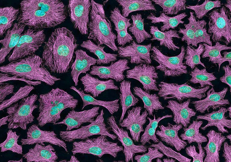 A History of HeLa Cells: How the Immortal Cells Advanced Biomedical ...