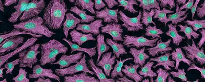 A History of HeLa Cells: How the Immortal Cells Advanced Biomedical ...